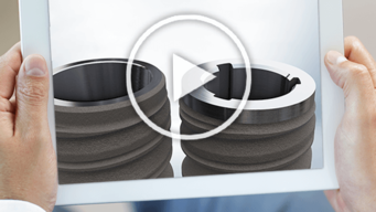 Camlog dental implant systems dental: overview of Camlog Implants