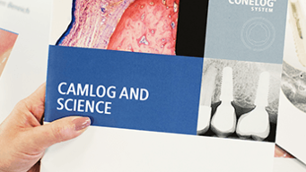Camlog dental implant systems dental: overview of Camlog Implants | Camlog